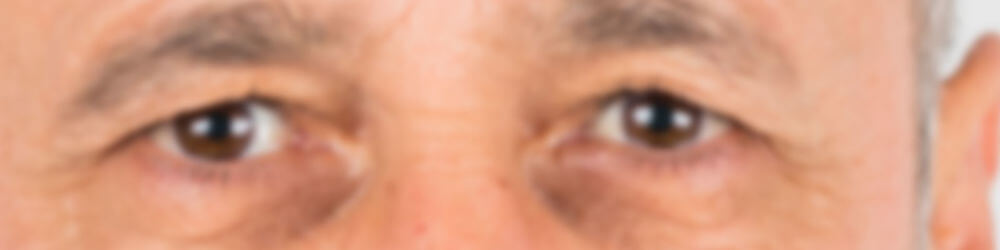 What Is Glaucoma and Why Should You Care? - Ben's Natural Health