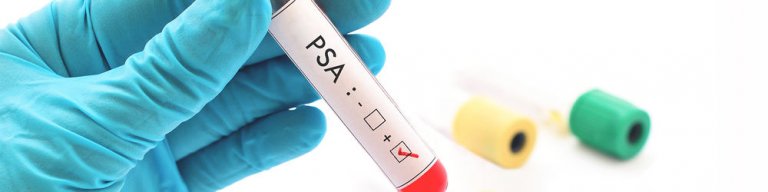 What Factors Can Affect Your PSA Levels? - Ben's Natural Health
