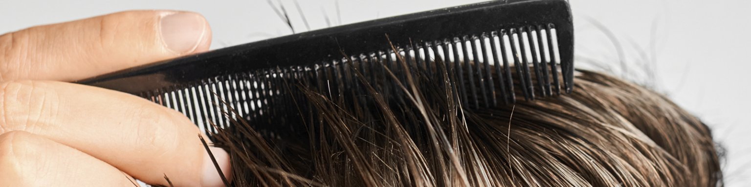 How To Reduce DHT Levels Naturally - Ben's Natural Health