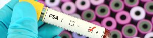 What Are Typical PSA Levels with BPH? - Ben's Natural Health