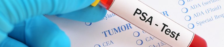 PSA Doubling Time: What Is It & How Can You Reduce It?