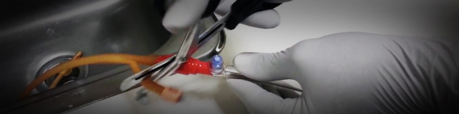 Doctor Answers: What Is Anuria and How to Treat It? - Ben's Natural Health